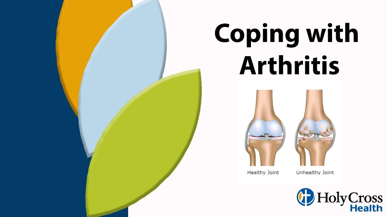 Living with Osteoarthritis: Expert Tips from Dr. Ian Singer - YouTube