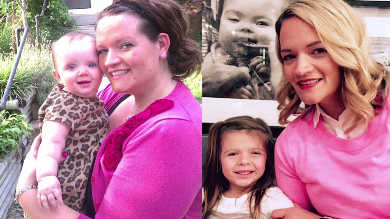 Dr Poulos Final cut before after 04 21 17 - YouTube