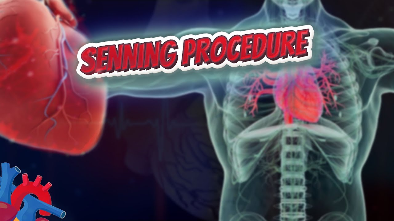 Senning procedure - Human Heart ️ and Cardiology ️🔊 - YouTube