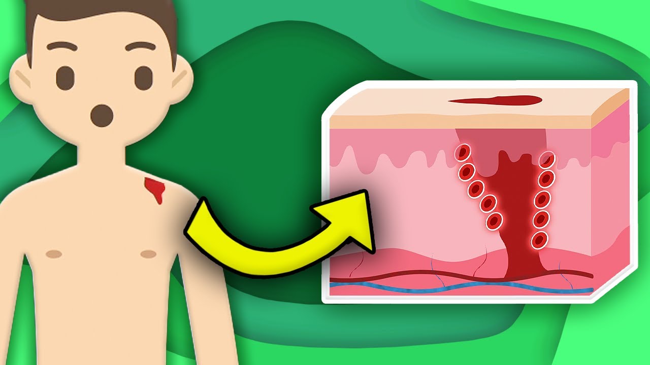 How Does YOUR Skin Heal? | KLT Anatomy - YouTube