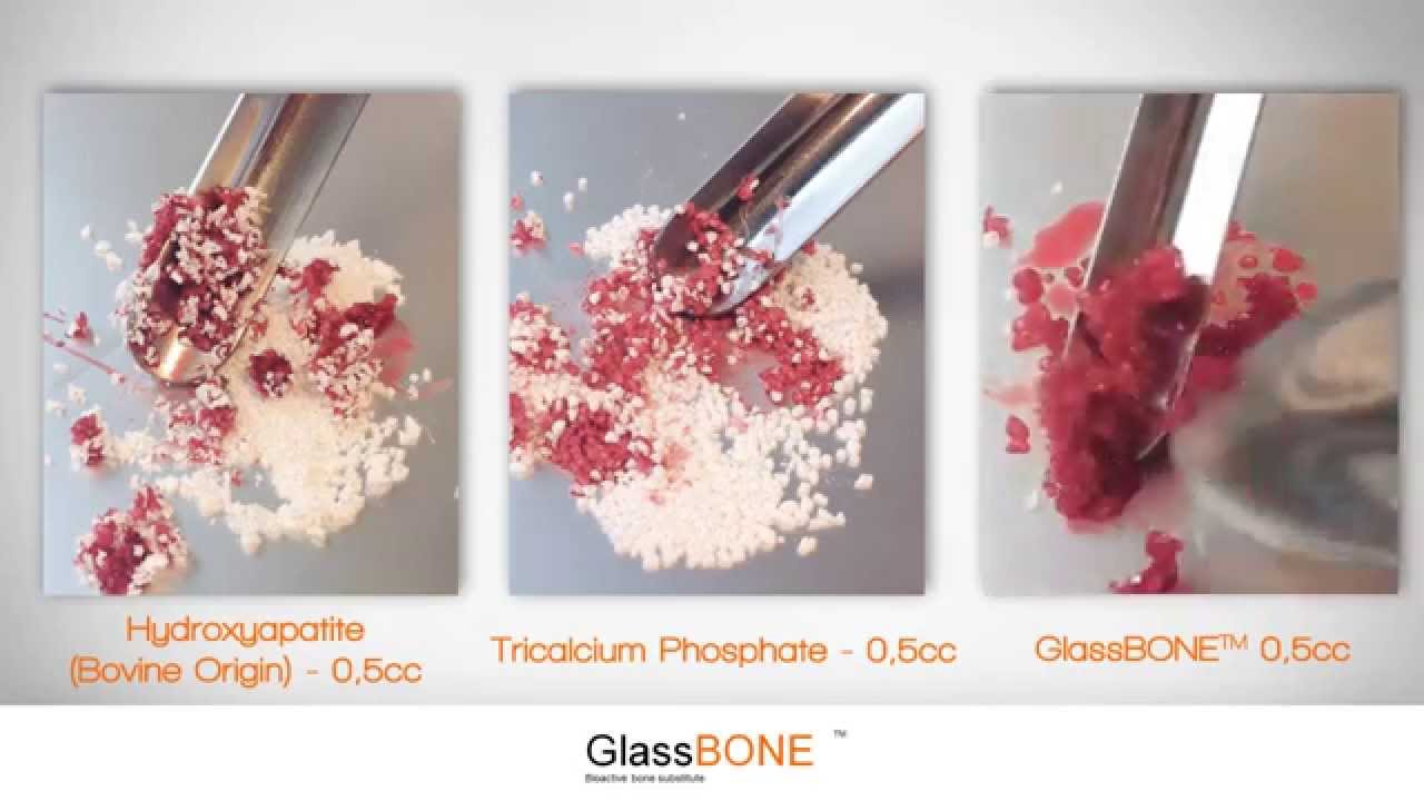 Noraker | Glassbone - Comparison Cohesiveness Blood Test - YouTube
