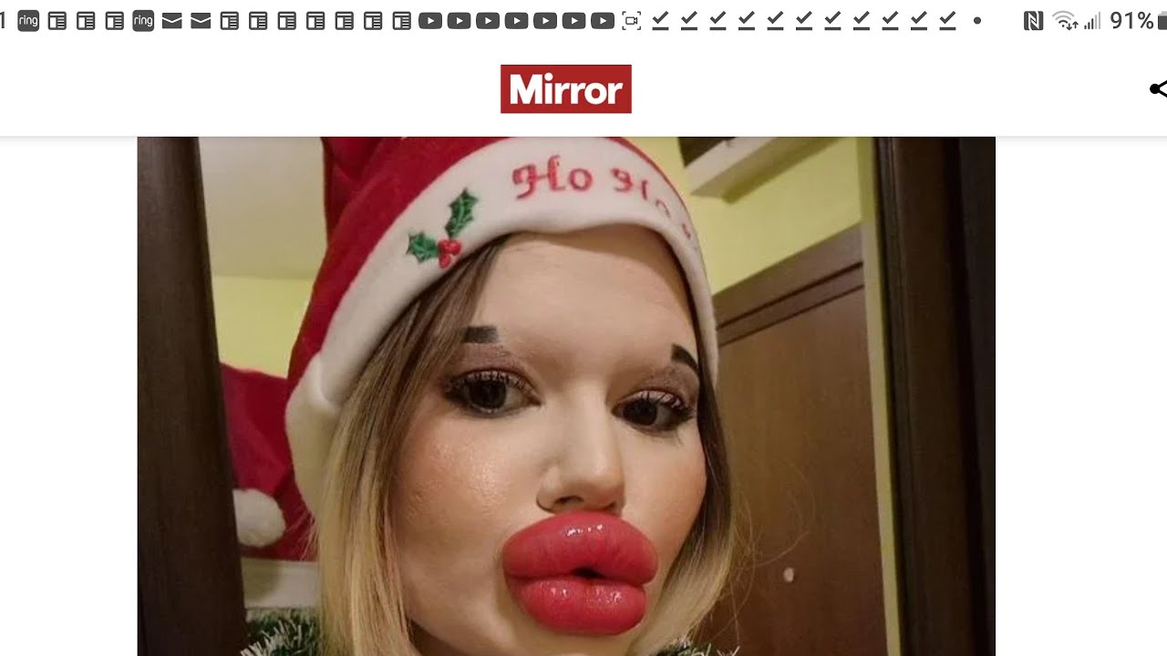 😲🤣Andrea Ivanova 26, Woman with world's biggest lips' Just made them ...
