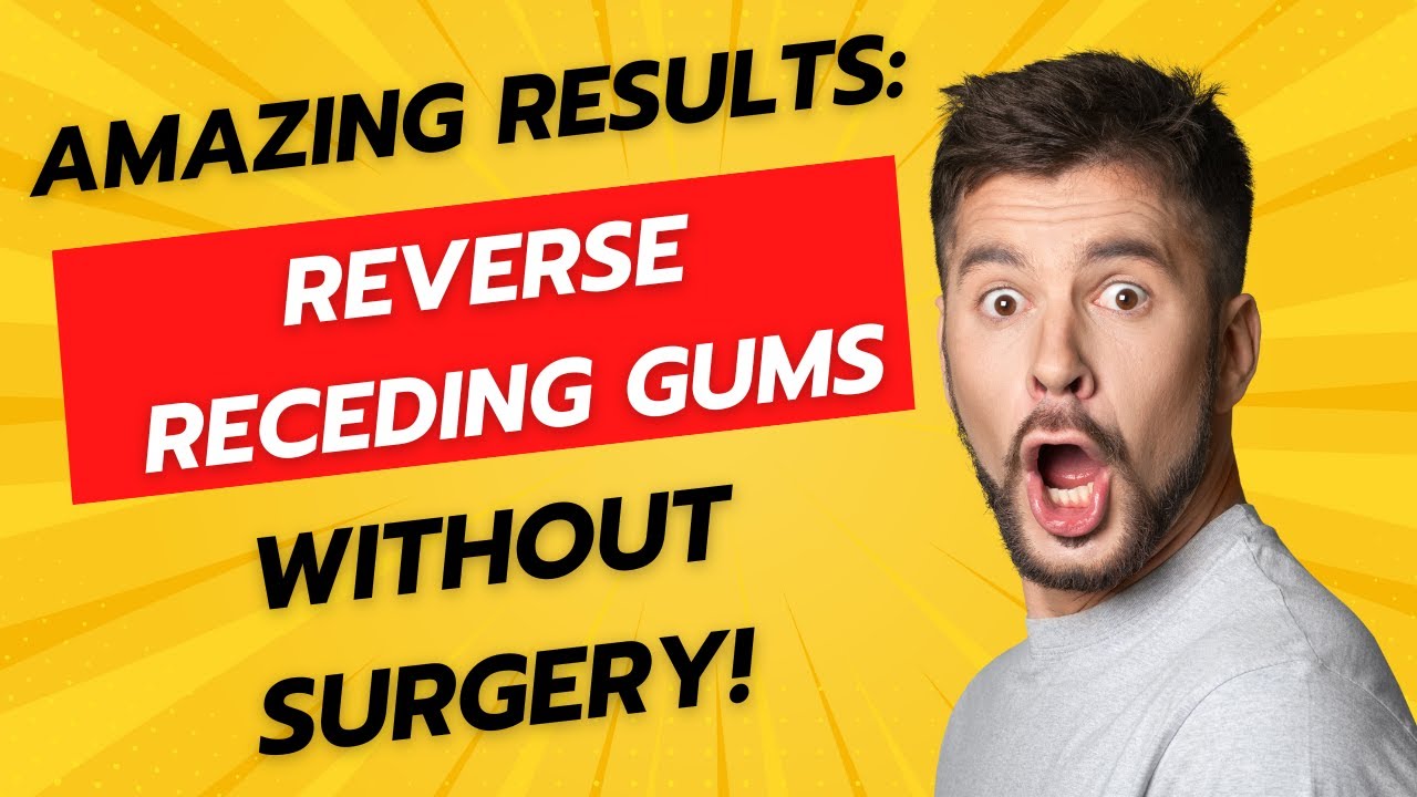 How To Reverse Receding Gums WITHOUT Surgery! - YouTube