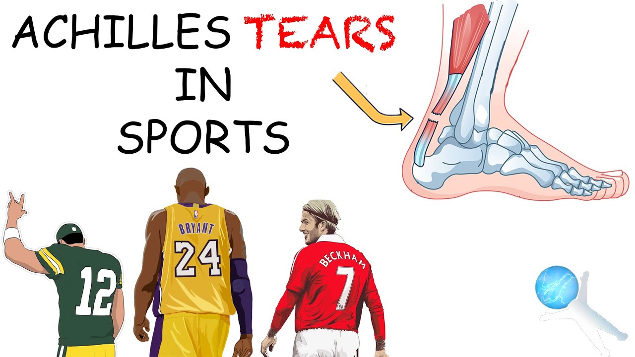 Achilles Tendon Rupture in Sports - Causes, Surgery, Rehab - YouTube