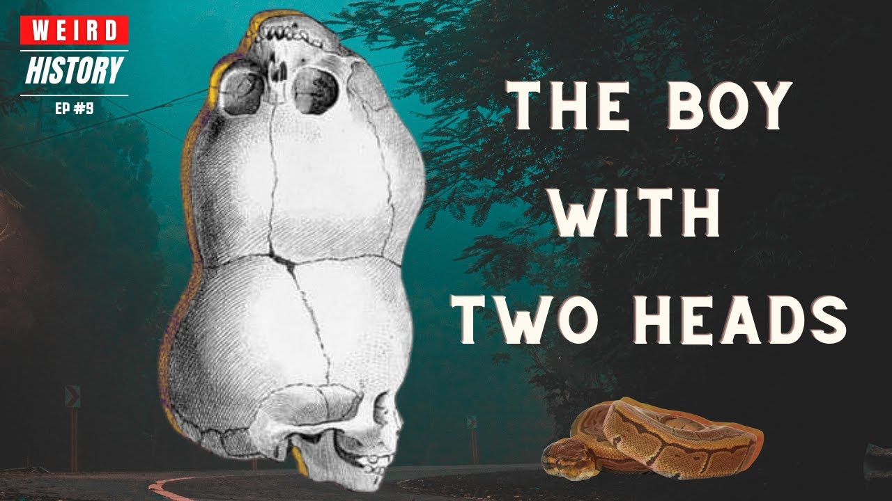 The Boy With Two Heads | Weird History Ep. #9 - YouTube