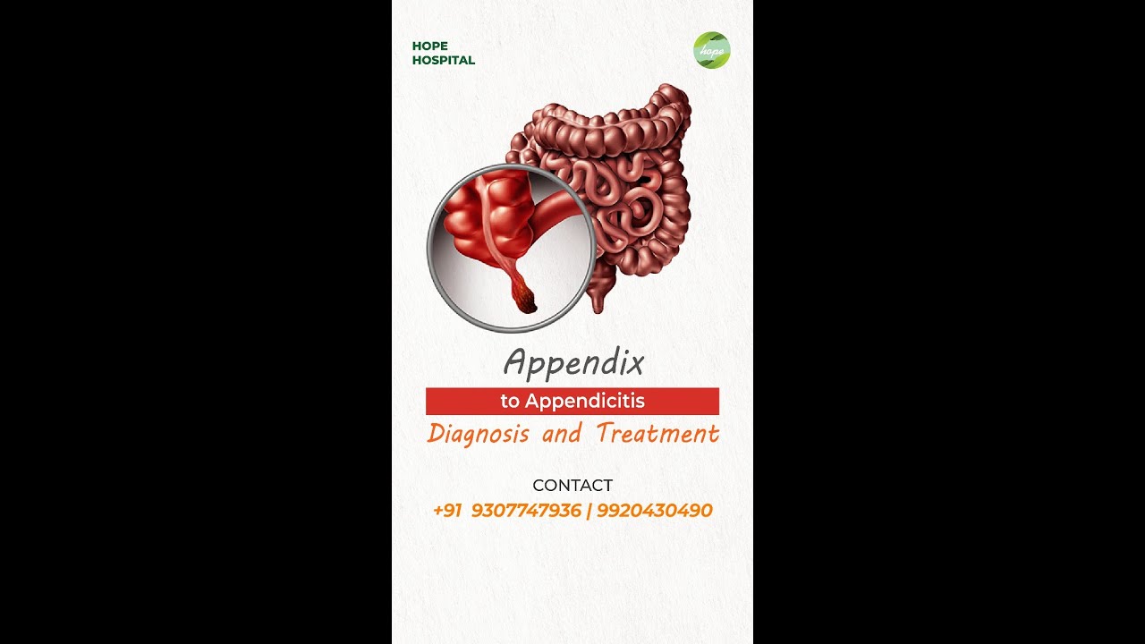 Appendix Explained | Expert Surgeon Dr. Pushkar Galam | Causes, Symptoms, Treatment #lifestyle ...