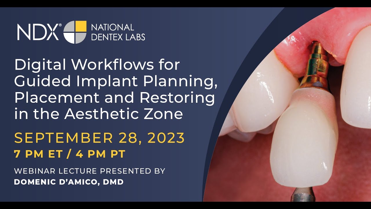 Digital Workflows for Guided Implant Planning, Placement and Restoring ...