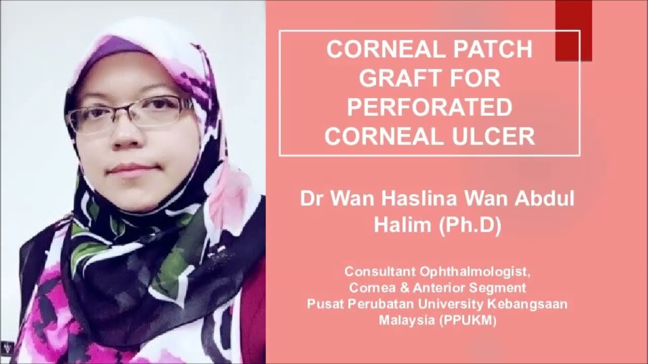 Corneal Patch Graft for Perforated Corneal Ulcer - YouTube