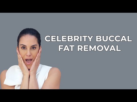 Buccal Fat Removal on Celebrities with Dr. Sheila Nazarian Beverly Hills | Nazarian Plastic Surgery