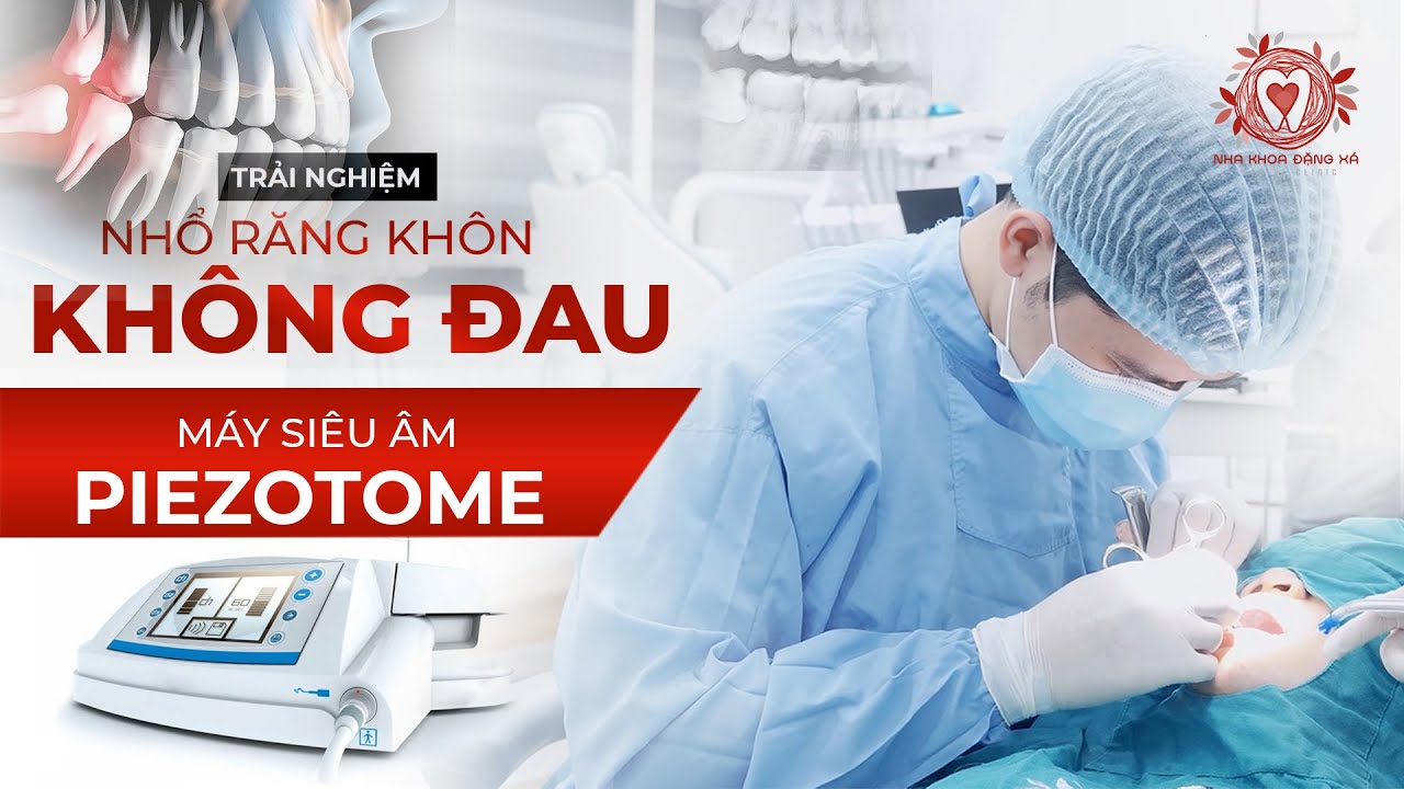 Trải Nghiệm Nhổ Răng Khôn Không Đau Bằng Sóng Siêu Âm Piezotom | Nha ...