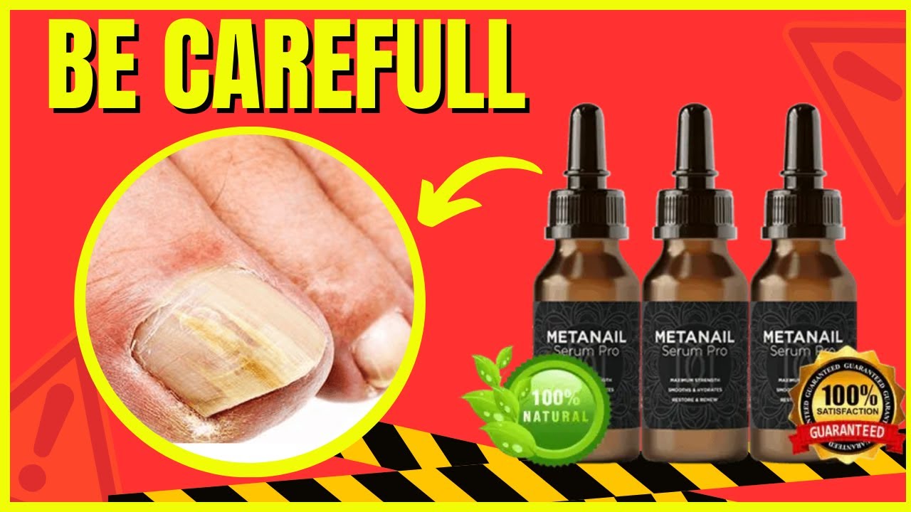 [METANAIL SERUM PRO] -⚠ALERT!⚠ - Meta Nails - Fungus Relief Supplement ...