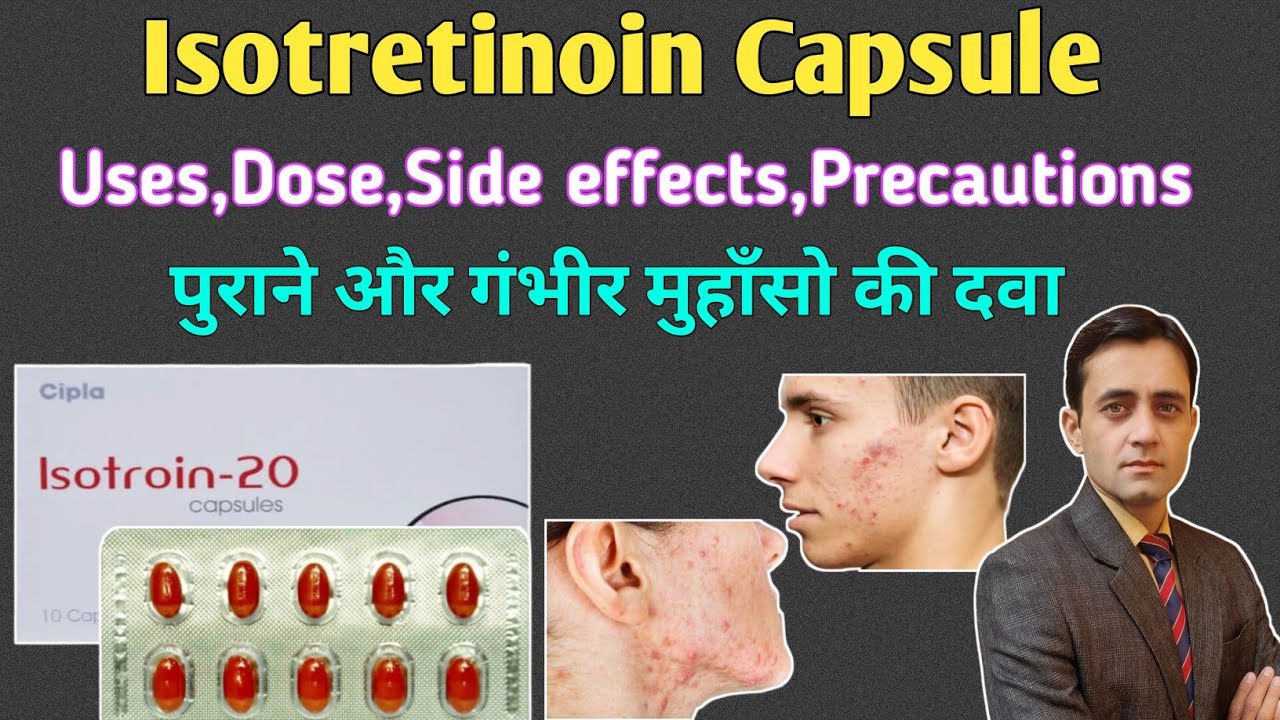 Isotretinoin capsules benefits and side effects / Isotretinoin capsules ...