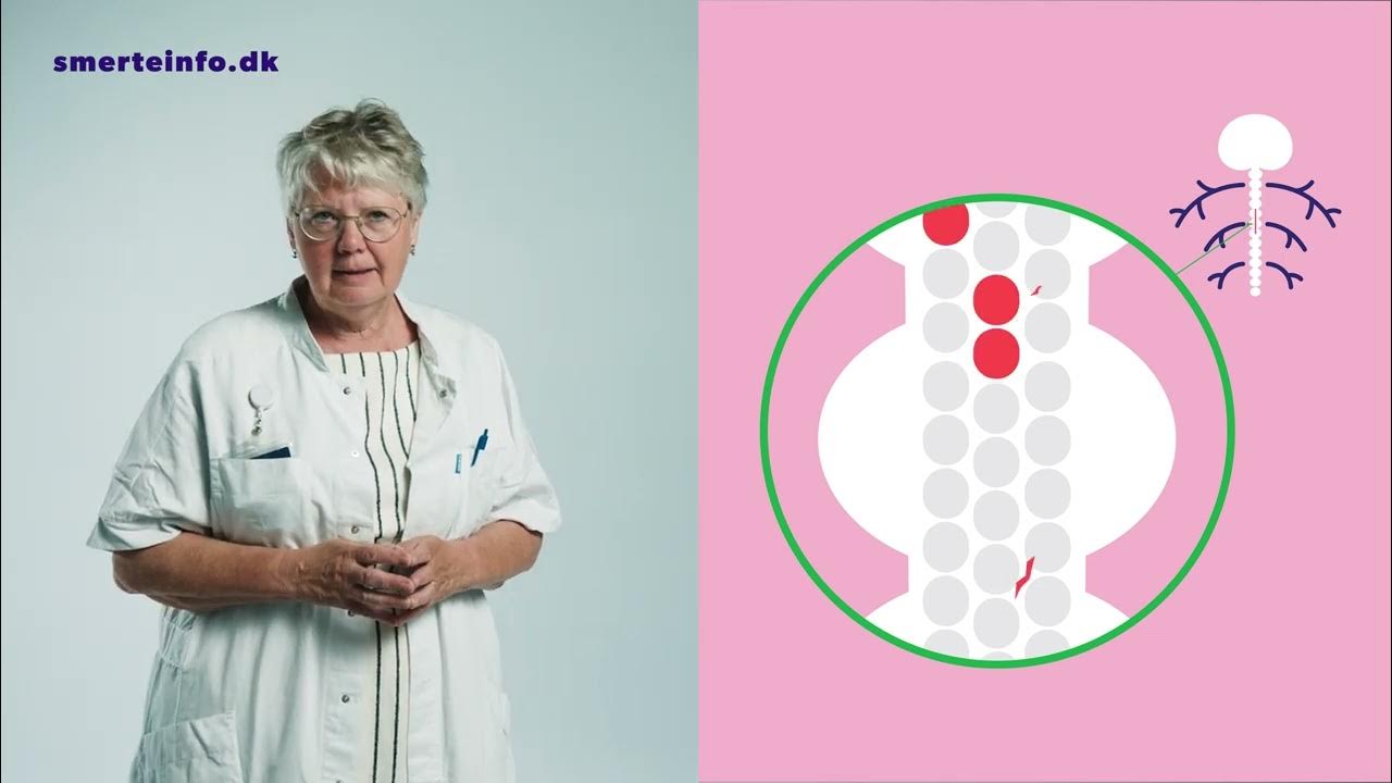 Pixibog om kroniske smerter - YouTube