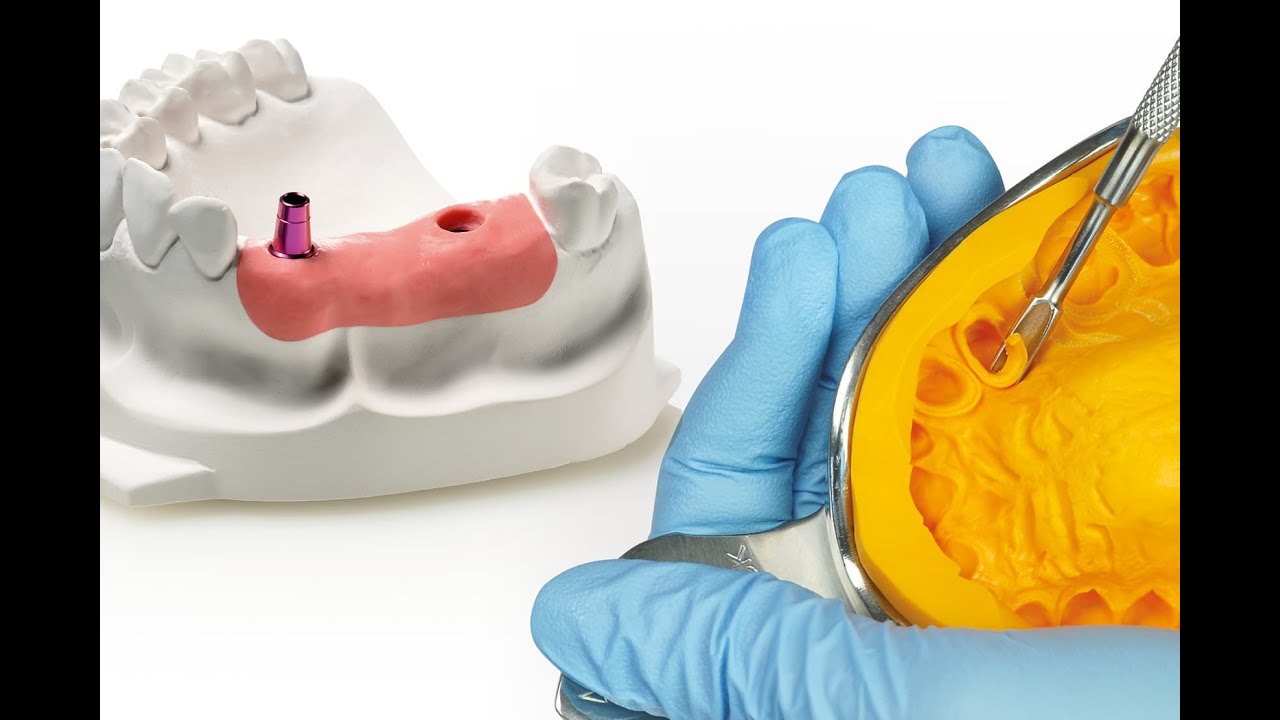 Elastic Impression Material / Hydrocolloids (Reversible and ...