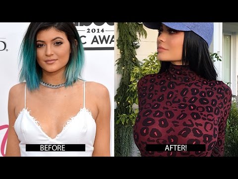 Kylie Jenner BOOB JOB?! New Bigger Chest Photos Spark Plastic Surgery Rumors