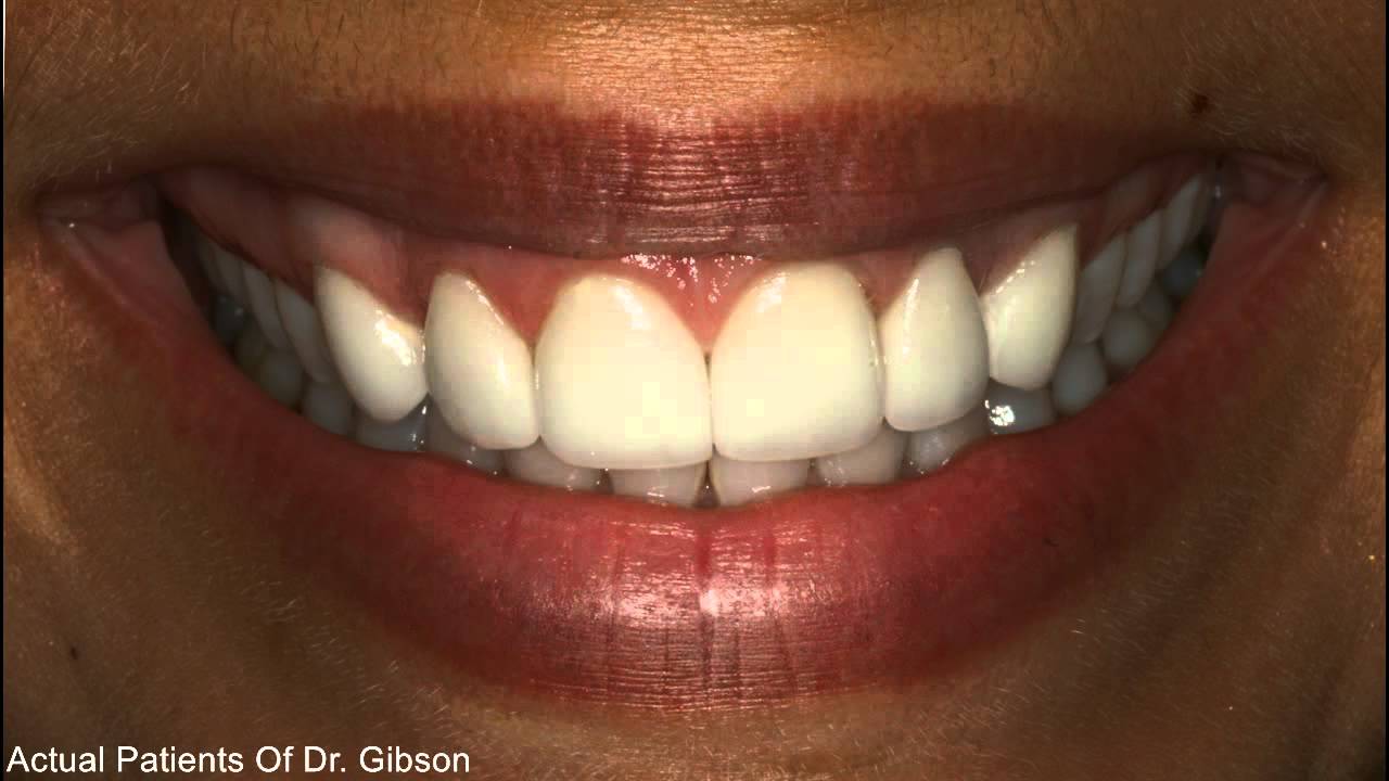 Dr. Chiann Fan Gibson - Extreme Faces Miracle Cases Makeovers - YouTube