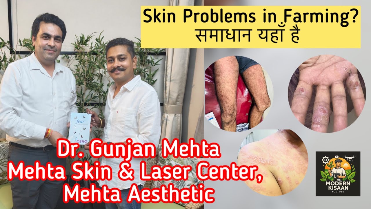 “खेत में काम करते किसान अपनी त्वचा कैसे बचाएं? | Dr. Gunjan Mehta से ...