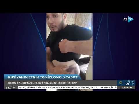 Rusiyada Azərbaycanlılara qaşı zorakılıq