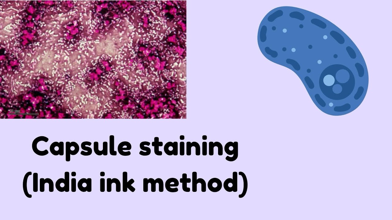 Capsule Staining | Microbiology |Staining techniques - YouTube