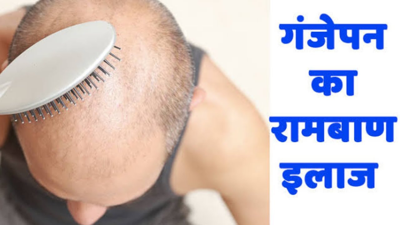 How to Regain Your Hair | Rogan badam shirin | Roghan zarareeh | Roghan ...