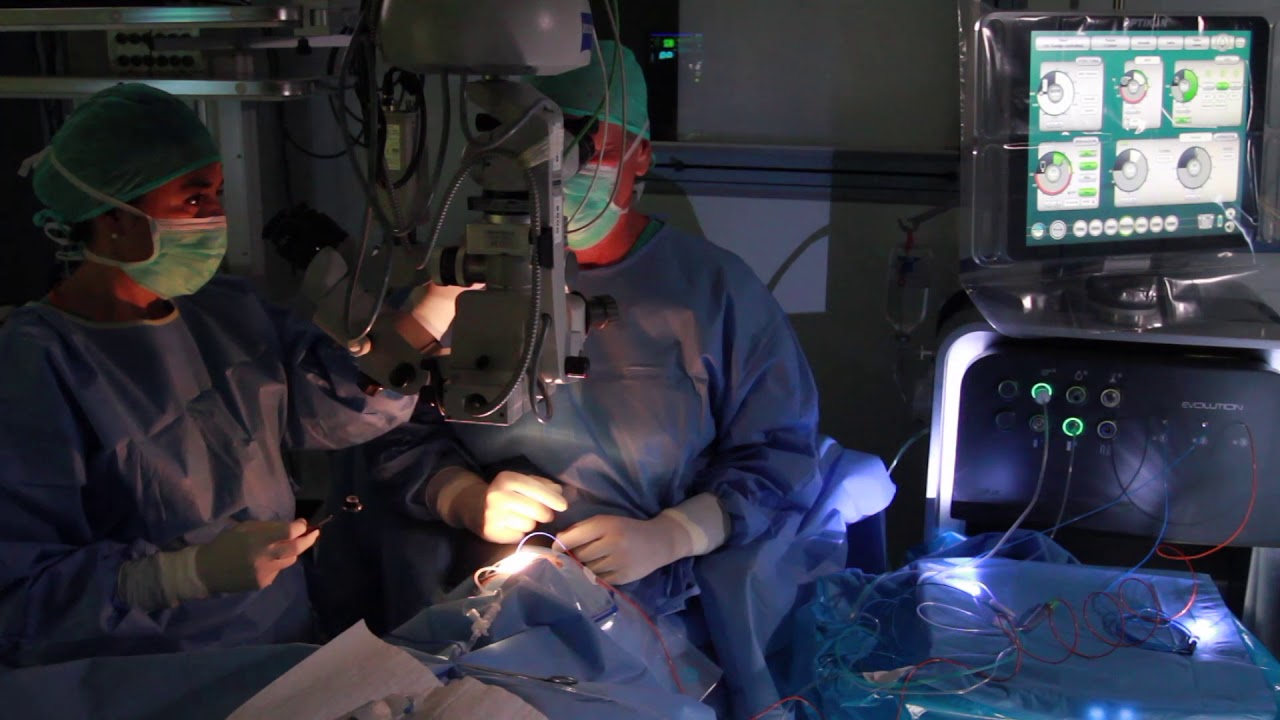 Retinal detachment with PVR C4 and subretinal macular membrane - YouTube