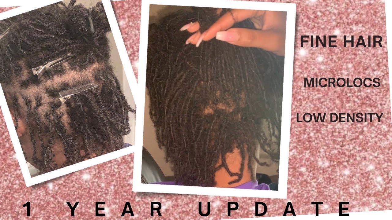 FINE HAIR || LOW DENSITY || MICROLOCS || LOC UPDATE - YouTube