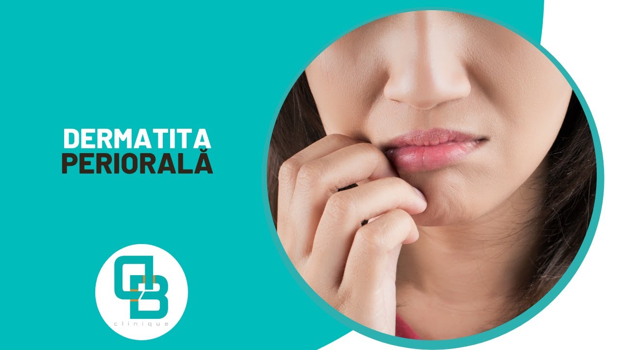 Dermatita periorala | DermaBeauty Clinique - YouTube