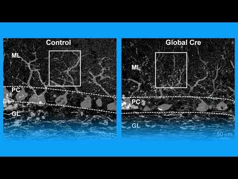Neuron (2017) - pubmed: 28472659  doi: 10.1016/j.neuron.2017.04.011