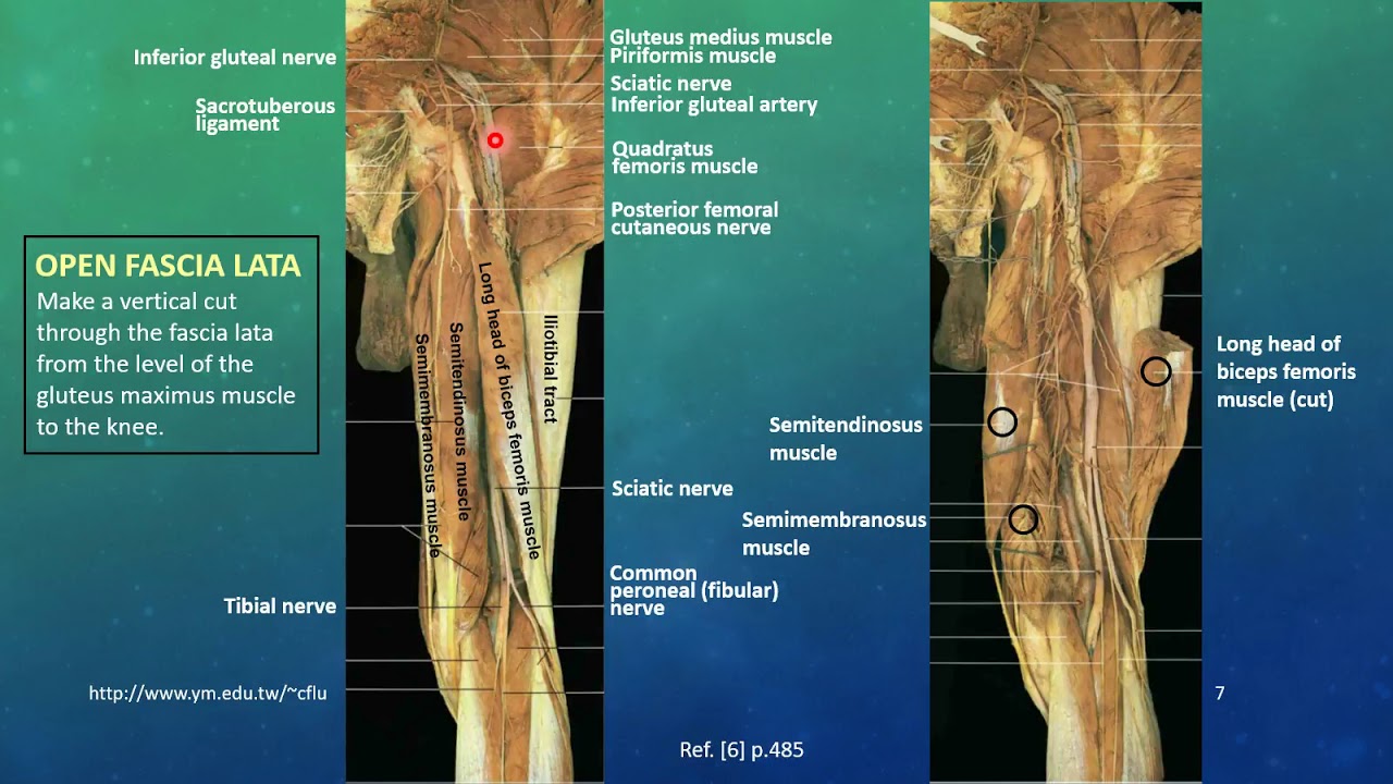[2017.12.18 Lesson25]Human Dissection - Posterior region of thigh & leg ...