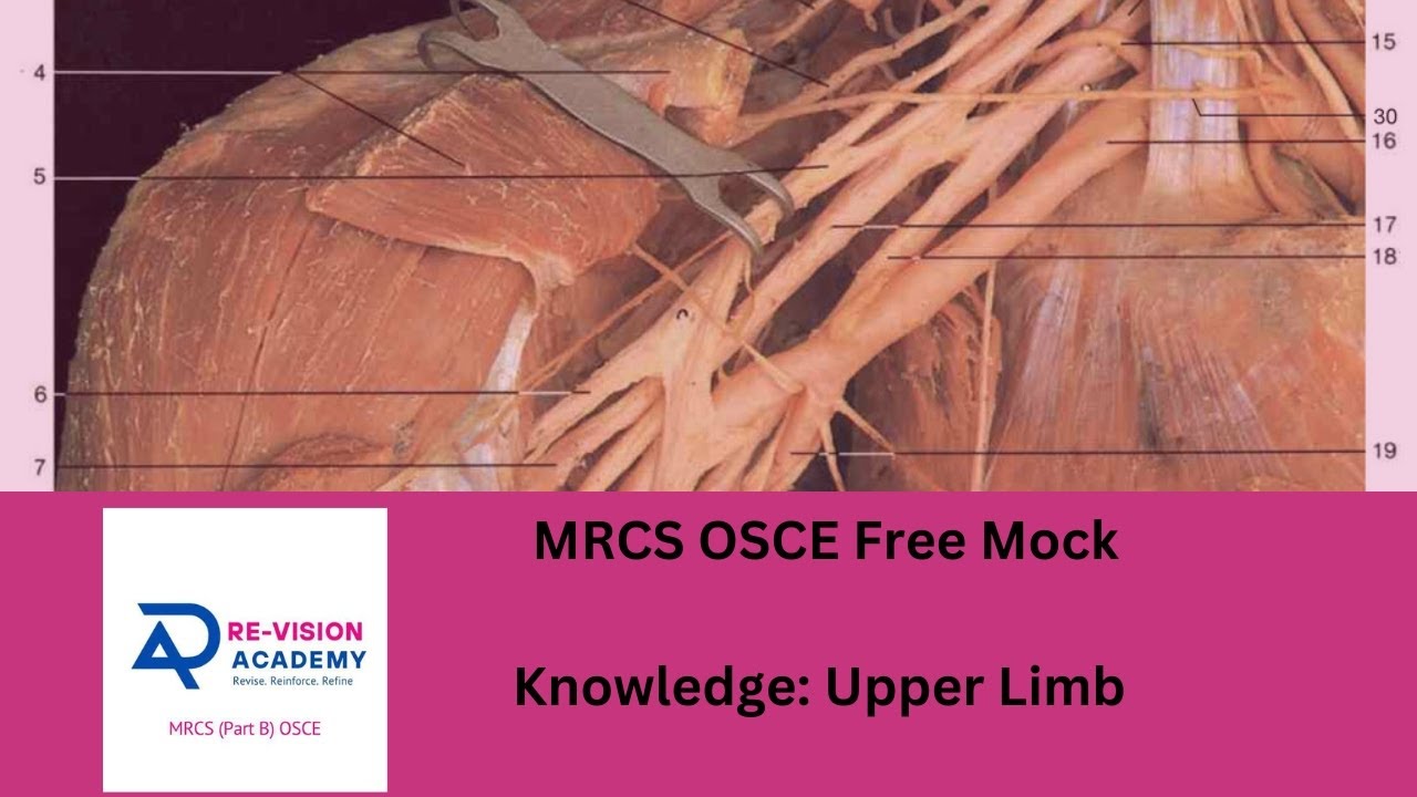 MRCS OSCE Mock : Anatomy : Upper Limb - YouTube