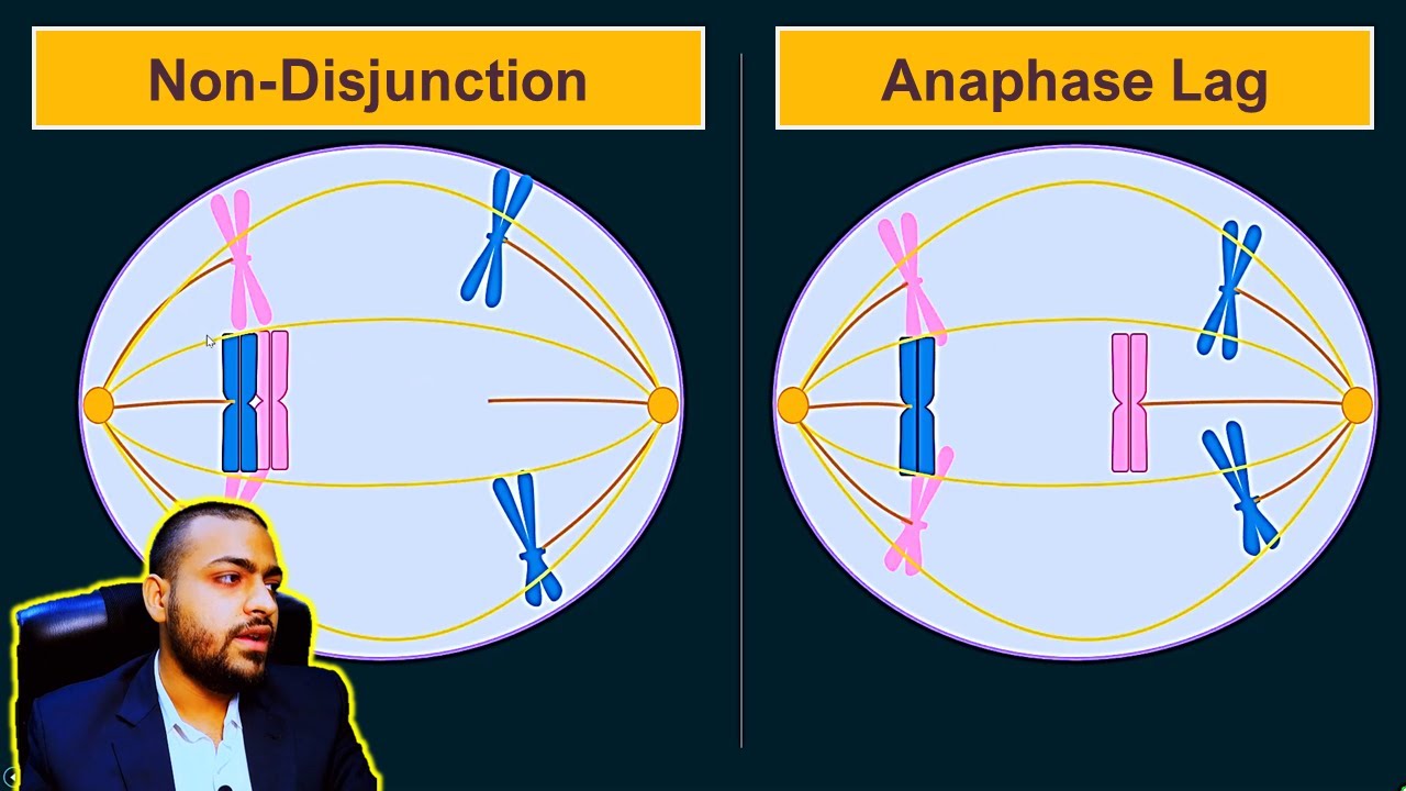 Anapahse Lag Difference Between Anaphase Lag And Non Disjunction anapahse-lag-difference-between-anaphase-lag-and-non-disjunction