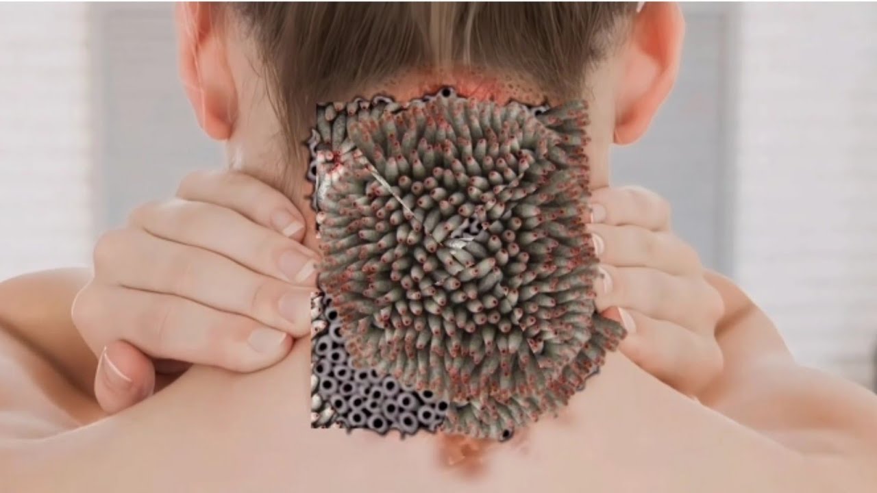 ASMR Animation Treatment Infected Body | 2D ASMR Animation - YouTube