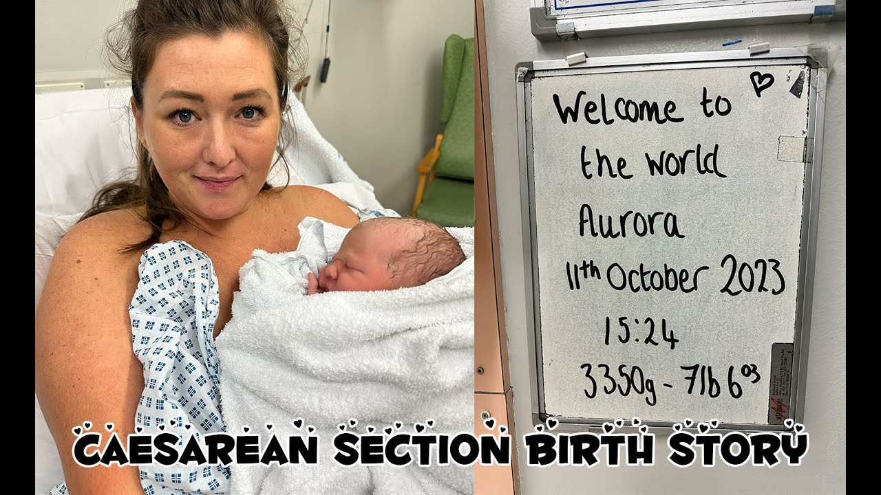 FULL CAESAREAN SECTION BIRTH STORY WITH QUESTIONS ANSWERED. - YouTube