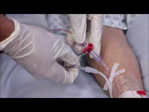 LiDCO Calibration Guide - How to set up the disposables - YouTube