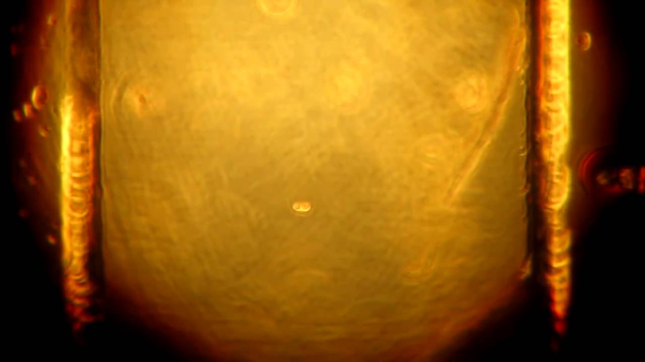 bRPE Cells through Microfluidic_0625_Unstained - YouTube