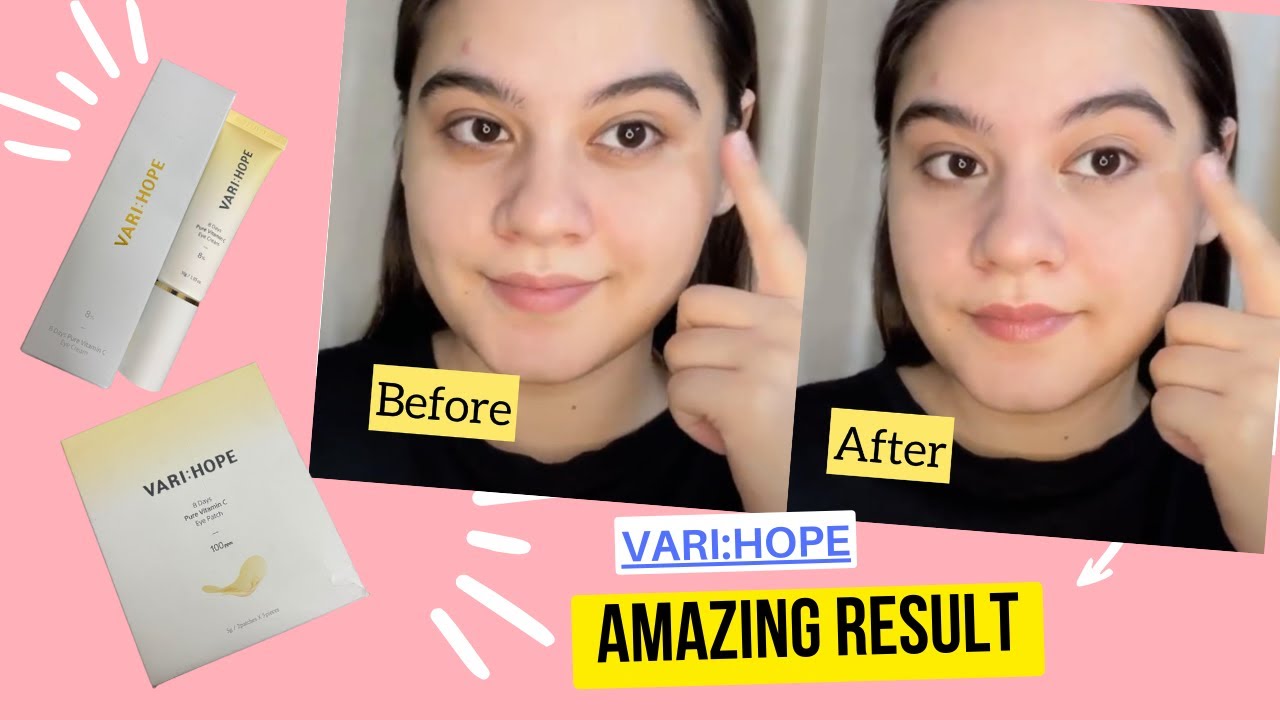 Transform Your Skin with VARI Hope Vitamin C Eye Path & Cream - YouTube