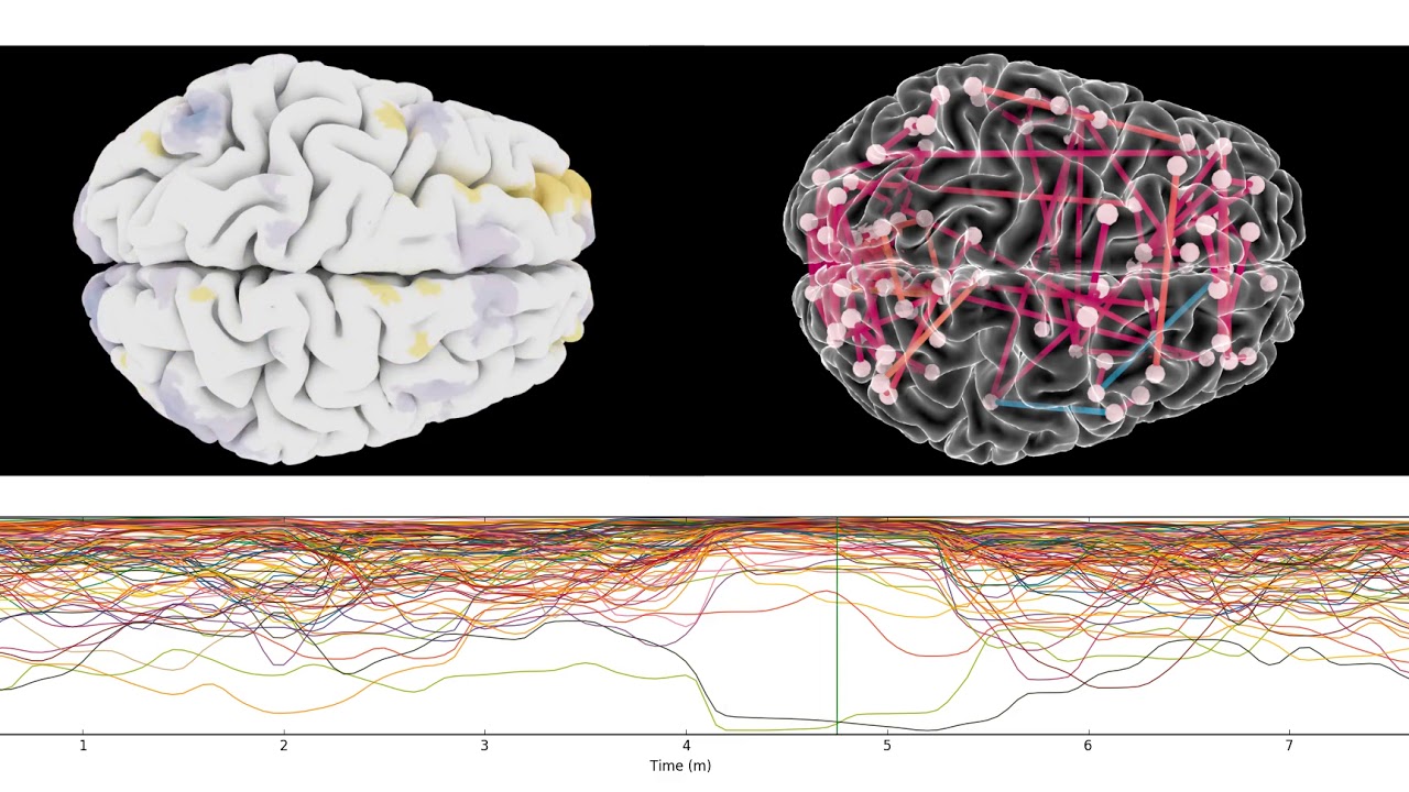fMRI resting state connectivity and raw - YouTube