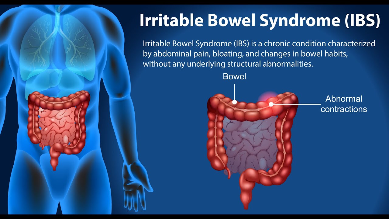 Irritable Bowel Syndrome (IBS) Frequency Healing - YouTube