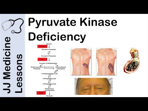 Pyruvate Kinase Deficiency | Symptoms, Pathophysiology, and Treatment