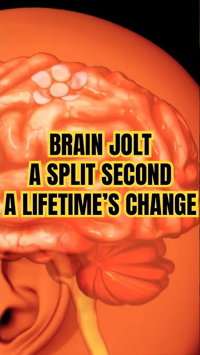 Brain Jolt: A Split Second, A Lifetime Change #braininjury #brainfunction #tbi #concussion # ...