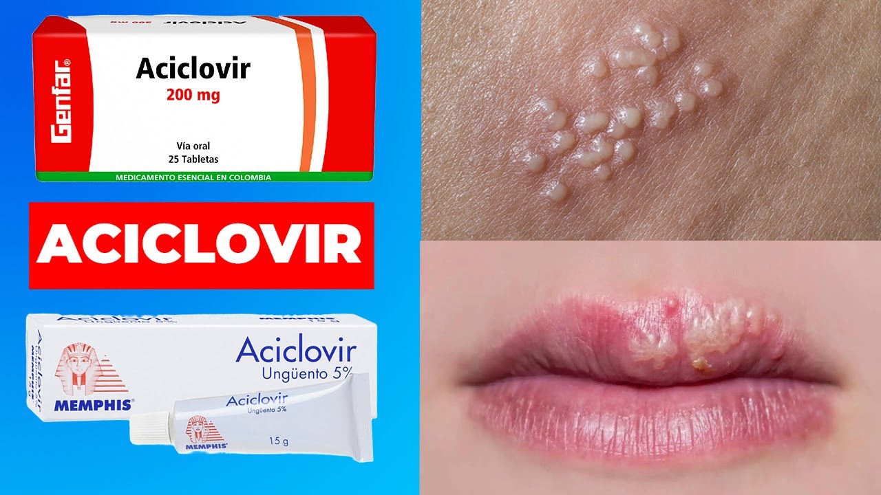 ACICLOVIR: PARA QUÉ SIRVE, CÓMO SE USA, EFECTOS SECUNDARIOS - YouTube