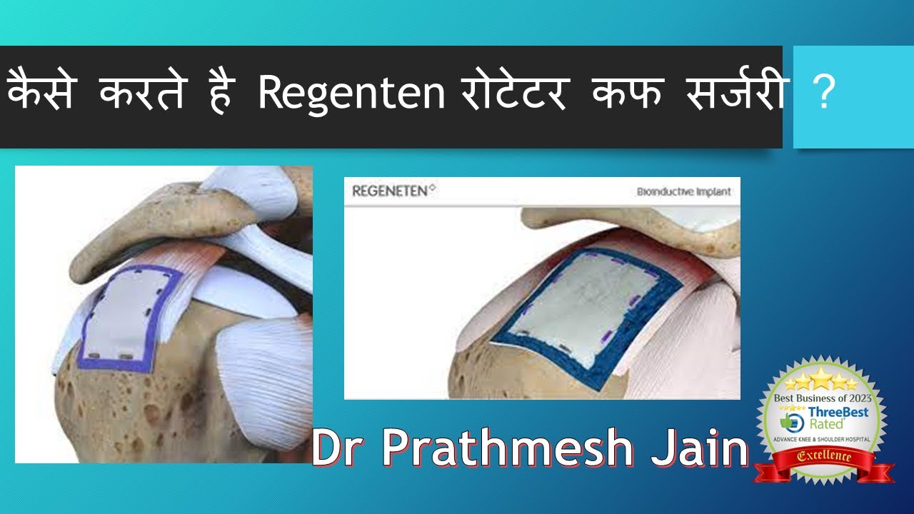 Shoulder rotator cuff repair ki latest technology Regenten कैसे करते है ...