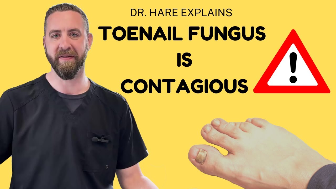 The Start Of Toenail Fungus: Dr. Hare DPM Reveals Treatments & More ...