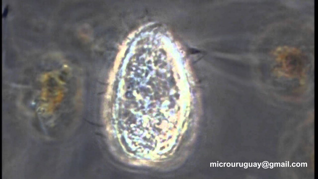 Ciliado Urotricha el trompo con garfios - Ciliate Urotricha the ...