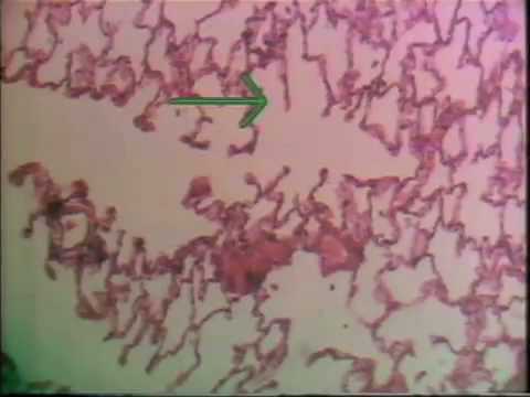 Review of Respiratory System