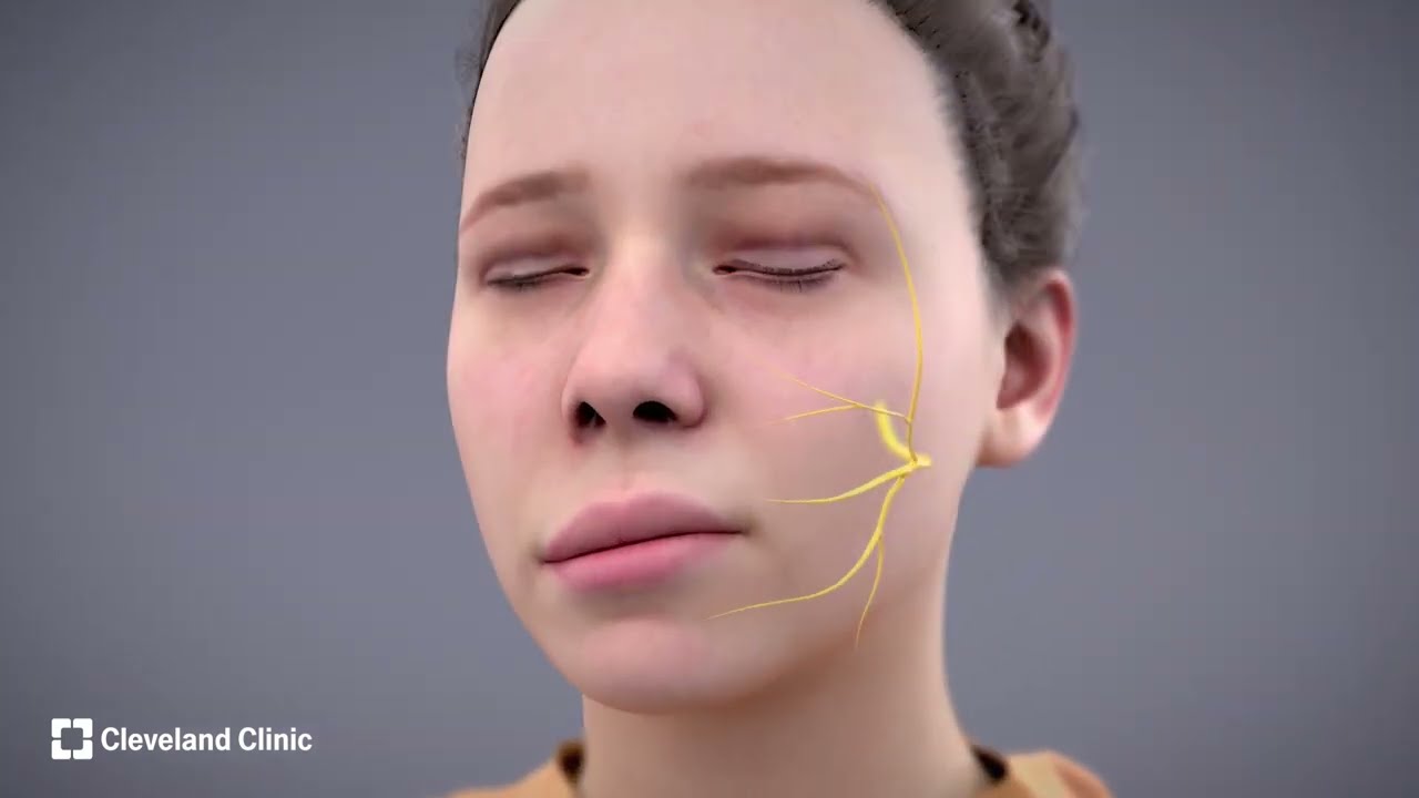 Patient with unilateral facial paralysis gets reanimation surgery