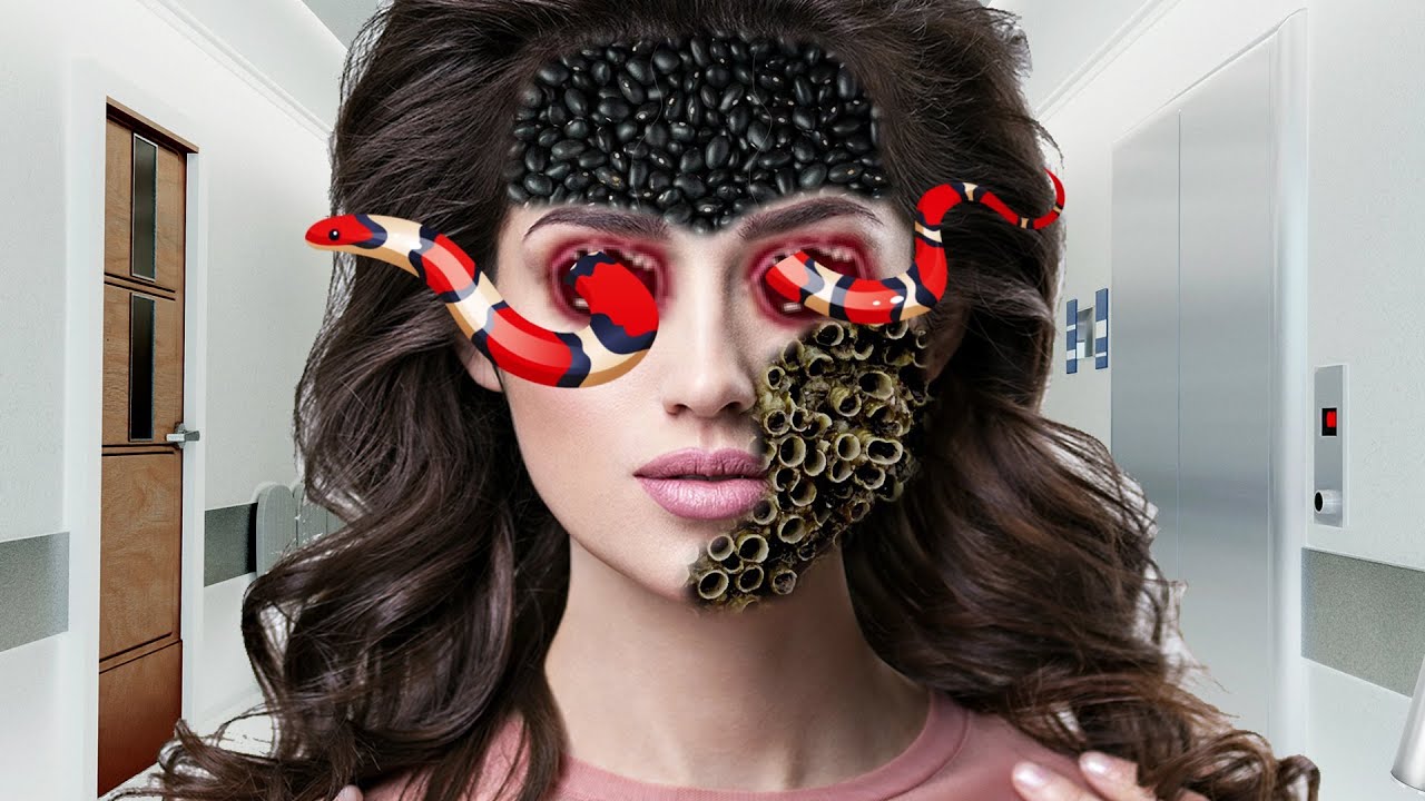 ASMR Remove Snake & Maggots in Face | ASMR Treatment | Deep Cleaning ...