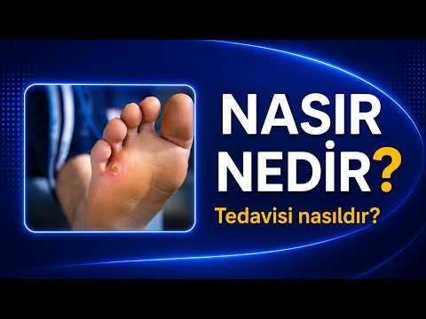 NASIR NEDİR? TEDAVİSİ NASILDIR?
