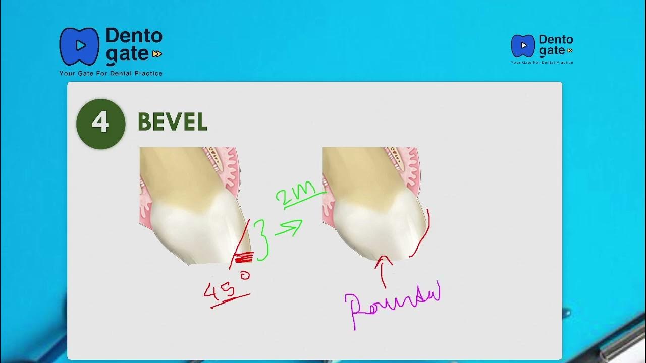 Bevel tricks for class IV - YouTube