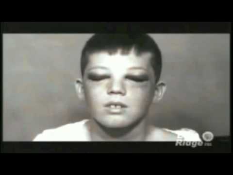 LOBOTOMY MOVIE - YouTube
